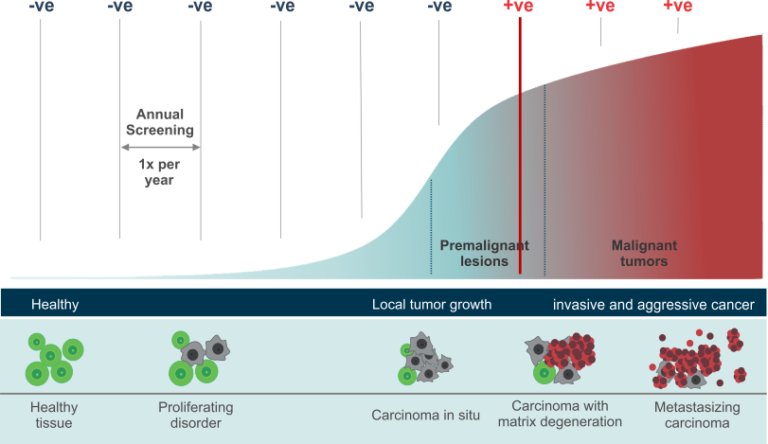PanTum® Detect – Millennium Cancer Center